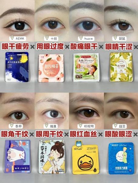 蒸汽眼罩对眼睛有害吗_蒸汽眼罩副作用有哪些-第2张图片-山城妙识 蒸汽眼罩对眼睛有害吗_蒸汽眼罩副作用有哪些-第2张图片-山城妙识