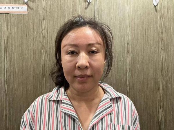 美容拉皮是怎么做的_拉皮手术全过程-第3张图片-山城妙识