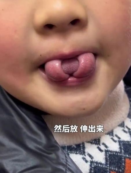 莲花卷舌怎么练_莲花卷舌图片真实吗-第3张图片-山城妙识