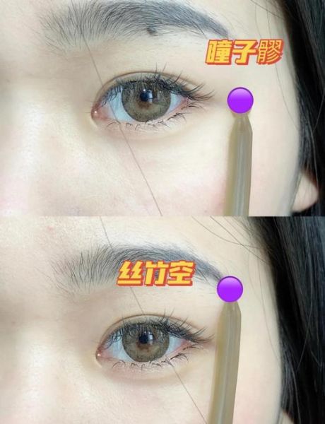 如何快速去黑眼圈_10分钟见效的方法-第2张图片-山城妙识 如何快速去黑眼圈_10分钟见效的方法-第2张图片-山城妙识