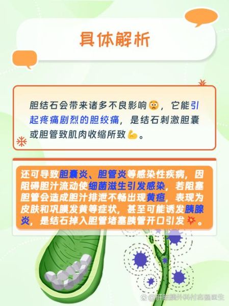 胆结石有什么症状_胆结石的危害有哪些-第3张图片-山城妙识