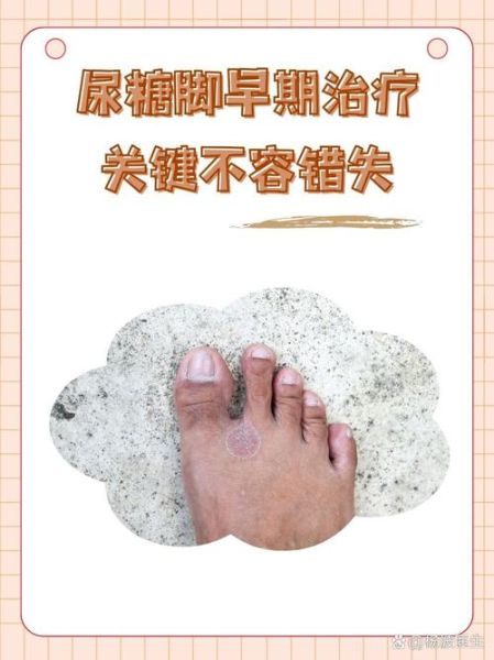 糖尿病只会一年比一年严重吗_如何阻止病情恶化-第3张图片-山城妙识 糖尿病只会一年比一年严重吗_如何阻止病情恶化-第3张图片-山城妙识