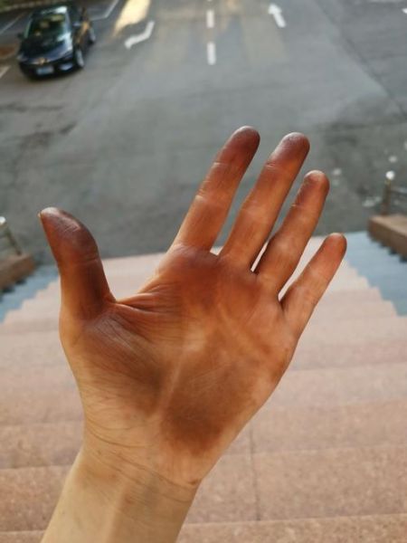 青皮核桃汁弄到手上怎么洗_手上青皮核桃汁洗不掉怎么办-第3张图片-山城妙识 青皮核桃汁弄到手上怎么洗_手上青皮核桃汁洗不掉怎么办-第3张图片-山城妙识