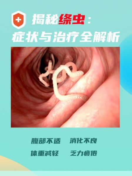 猪肉绦虫感染症状_潜伏期多久-第1张图片-山城妙识 猪肉绦虫感染症状_潜伏期多久-第1张图片-山城妙识