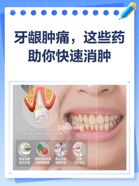牙龈肿痛怎么快速降火_牙龈肿痛吃什么药好得快-第3张图片-山城妙识 牙龈肿痛怎么快速降火_牙龈肿痛吃什么药好得快-第3张图片-山城妙识