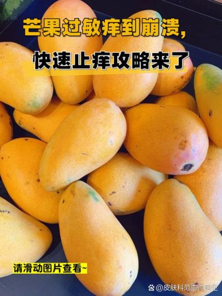芒果过敏怎么治疗_芒果过敏最快缓解方法-第3张图片-山城妙识