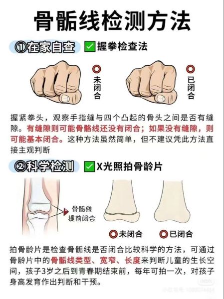 身高不长了的前兆_如何判断骨骼线闭合-第3张图片-山城妙识 身高不长了的前兆_如何判断骨骼线闭合-第3张图片-山城妙识