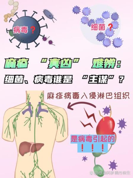 麻子是什么病_麻子会传染吗-第1张图片-山城妙识
