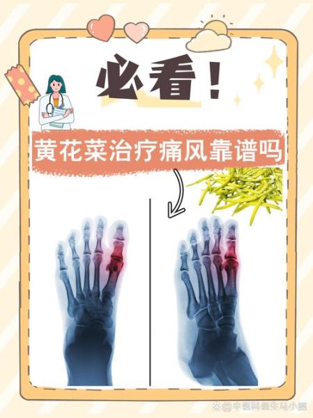 金针菜对痛风有好处吗_痛风能不能吃金针菜-第3张图片-山城妙识