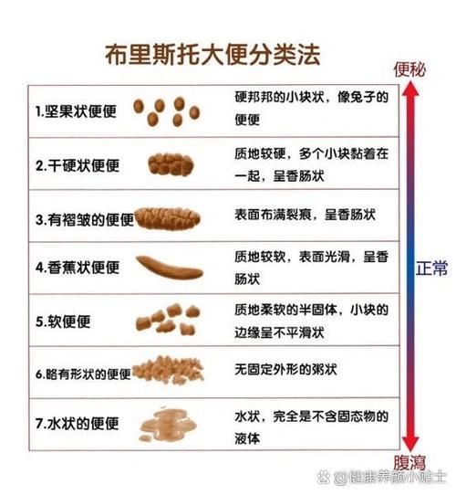 5天不拉屎大便哪去了_便秘原因与危害-第1张图片-山城妙识