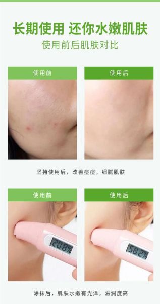 芦荟胶用久了脸会变黑吗_为什么脸越用越暗沉-第1张图片-山城妙识 芦荟胶用久了脸会变黑吗_为什么脸越用越暗沉-第1张图片-山城妙识