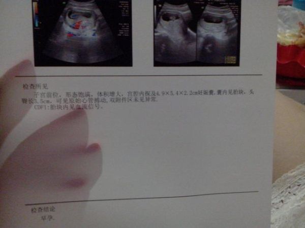 怀男宝女宝分泌物不一样_怎么区分-第2张图片-山城妙识 怀男宝女宝分泌物不一样_怎么区分-第2张图片-山城妙识