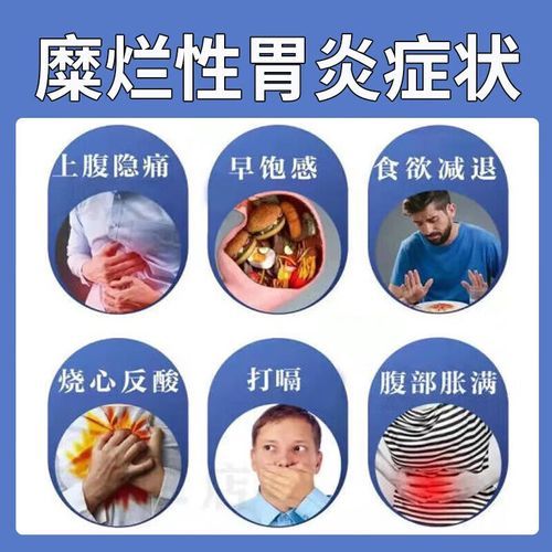 糜烂性胃炎吃什么药最好_糜烂性胃炎吃什么药最好最快-第1张图片-山城妙识