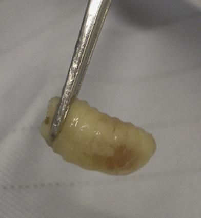 莲蓬乳病是什么_莲蓬乳病会传染吗-第3张图片-山城妙识