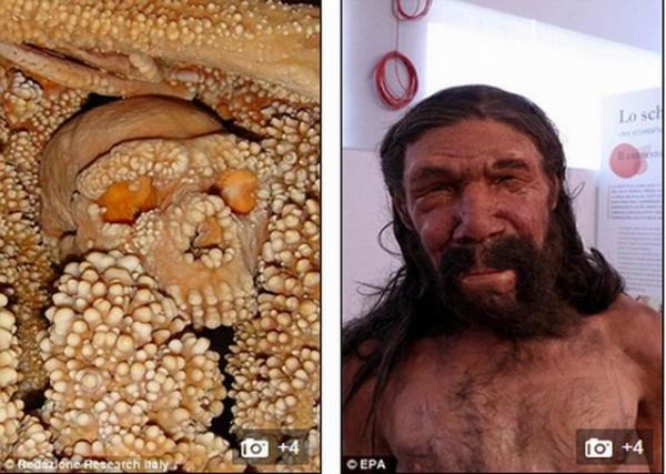 莲蓬乳病是什么_莲蓬乳病会传染吗-第1张图片-山城妙识