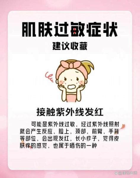 过敏症状一般持续几天_多久能彻底好-第3张图片-山城妙识 过敏症状一般持续几天_多久能彻底好-第3张图片-山城妙识