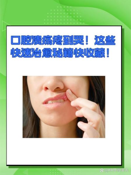 长期口腔溃疡怎么治疗_反复发作怎么办-第1张图片-山城妙识 长期口腔溃疡怎么治疗_反复发作怎么办-第1张图片-山城妙识