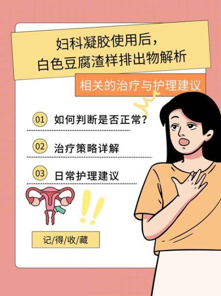 白带像豆腐渣怎么办_豆腐渣白带用什么药-第2张图片-山城妙识 白带像豆腐渣怎么办_豆腐渣白带用什么药-第2张图片-山城妙识