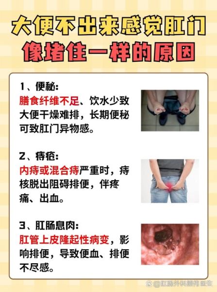 大便拉不出来怎么办_快速解决方法-第3张图片-山城妙识 大便拉不出来怎么办_快速解决方法-第3张图片-山城妙识