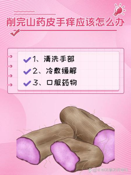 削山药手痒怎么办_山药黏液过敏止痒方法-第1张图片-山城妙识 削山药手痒怎么办_山药黏液过敏止痒方法-第1张图片-山城妙识