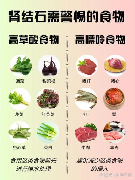 肾结石吃什么好_肾结石饮食禁忌有哪些-第3张图片-山城妙识