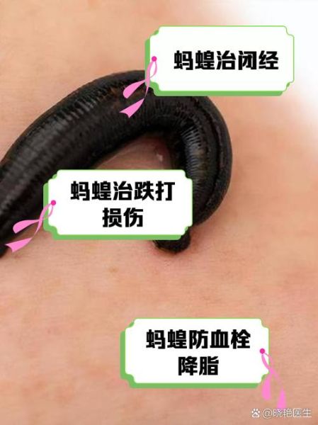 水蛭的功效与作用_水蛭的副作用有哪些-第1张图片-山城妙识 水蛭的功效与作用_水蛭的副作用有哪些-第1张图片-山城妙识