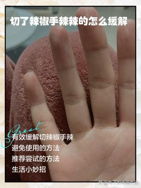 辣椒辣手多久会消失_如何快速缓解灼烧感-第1张图片-山城妙识