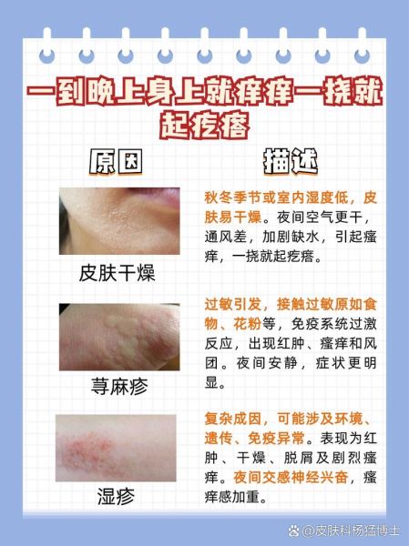 皮肤痒一抓就起疙瘩怎么回事_皮肤痒一抓就起疙瘩怎么办-第1张图片-山城妙识 皮肤痒一抓就起疙瘩怎么回事_皮肤痒一抓就起疙瘩怎么办-第1张图片-山城妙识