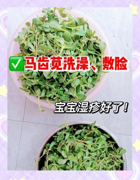 马齿苋治湿疹的正确用法_马齿苋治湿疹多久见效-第2张图片-山城妙识 马齿苋治湿疹的正确用法_马齿苋治湿疹多久见效-第2张图片-山城妙识
