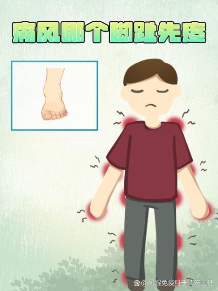 脚疼是不是痛风_痛风脚疼怎么判断-第2张图片-山城妙识