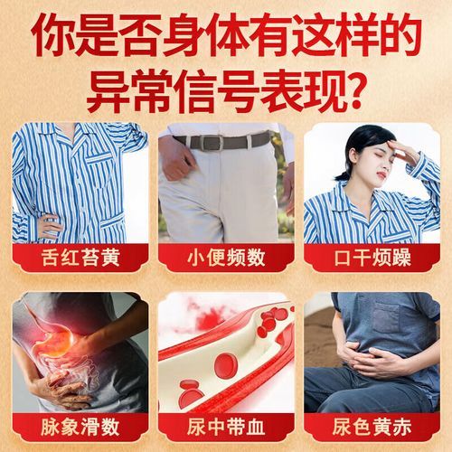 小蓟饮子功效与作用_小蓟饮子怎么服用-第3张图片-山城妙识 小蓟饮子功效与作用_小蓟饮子怎么服用-第3张图片-山城妙识