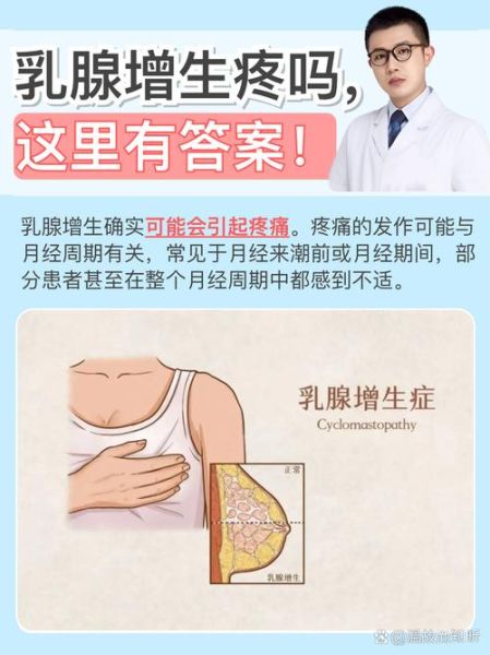 乳腺增生有哪些症状_乳腺增生会疼吗-第2张图片-山城妙识 乳腺增生有哪些症状_乳腺增生会疼吗-第2张图片-山城妙识