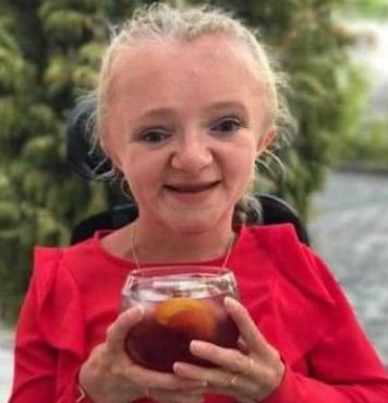 脆骨病的症状是什么_脆骨病有哪些表现-第1张图片-山城妙识