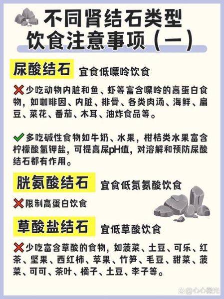 肾结石吃什么食物_肾结石饮食禁忌有哪些-第2张图片-山城妙识 肾结石吃什么食物_肾结石饮食禁忌有哪些-第2张图片-山城妙识