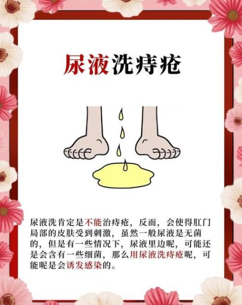 痔疮永不复发祖传秘方_痔疮根治偏方真的有效吗-第2张图片-山城妙识 痔疮永不复发祖传秘方_痔疮根治偏方真的有效吗-第2张图片-山城妙识