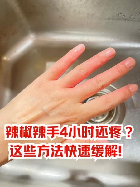 辣椒辣到手了怎么办_最快缓解方法-第2张图片-山城妙识 辣椒辣到手了怎么办_最快缓解方法-第2张图片-山城妙识