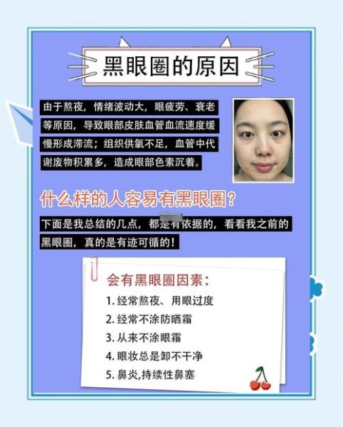 黑眼圈很重怎么改善_黑眼圈很重如何快速消除-第1张图片-山城妙识 黑眼圈很重怎么改善_黑眼圈很重如何快速消除-第1张图片-山城妙识