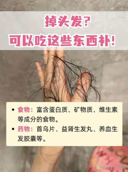 防掉发吃什么食物_掉发严重吃什么能改善-第3张图片-山城妙识