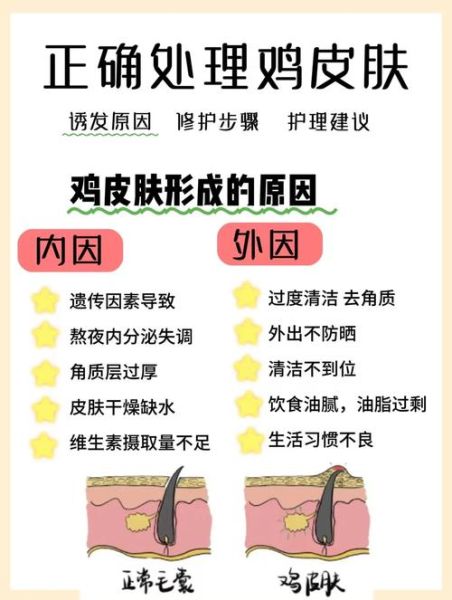 鸡皮肤怎么消除偏方_鸡皮肤用什么最有效-第2张图片-山城妙识 鸡皮肤怎么消除偏方_鸡皮肤用什么最有效-第2张图片-山城妙识