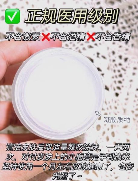 鸡皮肤怎么消除偏方_鸡皮肤用什么最有效-第3张图片-山城妙识 鸡皮肤怎么消除偏方_鸡皮肤用什么最有效-第3张图片-山城妙识