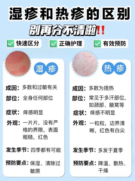 血热的症状有哪些_湿疹反复发作怎么办-第1张图片-山城妙识