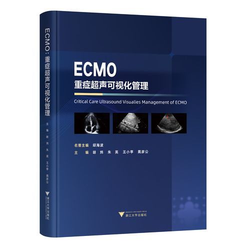 ecmo为什么那么贵_ecmo一天多少钱-第3张图片-山城妙识 ecmo为什么那么贵_ecmo一天多少钱-第3张图片-山城妙识