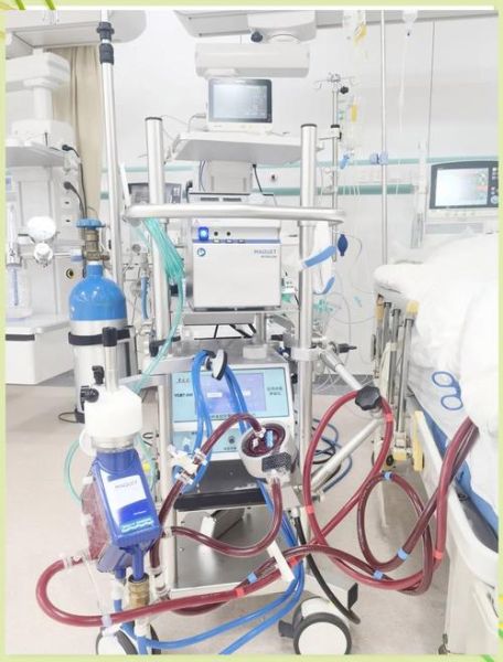 ecmo为什么那么贵_ecmo一天多少钱-第2张图片-山城妙识 ecmo为什么那么贵_ecmo一天多少钱-第2张图片-山城妙识