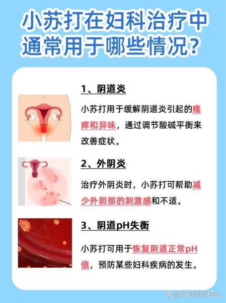 妇科炎症用小苏打有用吗_正确使用方法-第2张图片-山城妙识 妇科炎症用小苏打有用吗_正确使用方法-第2张图片-山城妙识