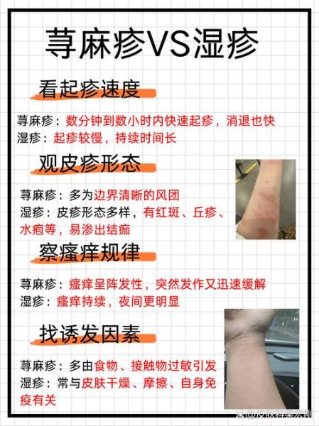 皮肤过敏红痒怎么办_快速止痒方法-第3张图片-山城妙识 皮肤过敏红痒怎么办_快速止痒方法-第3张图片-山城妙识