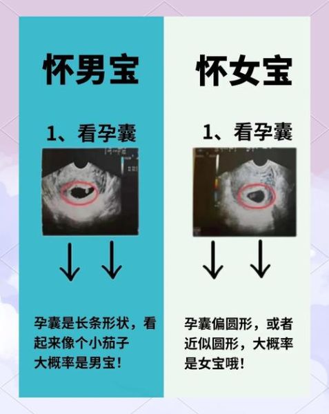 孕初期一招看男女是真的吗_孕早期怎么判断男女-第1张图片-山城妙识 孕初期一招看男女是真的吗_孕早期怎么判断男女-第1张图片-山城妙识