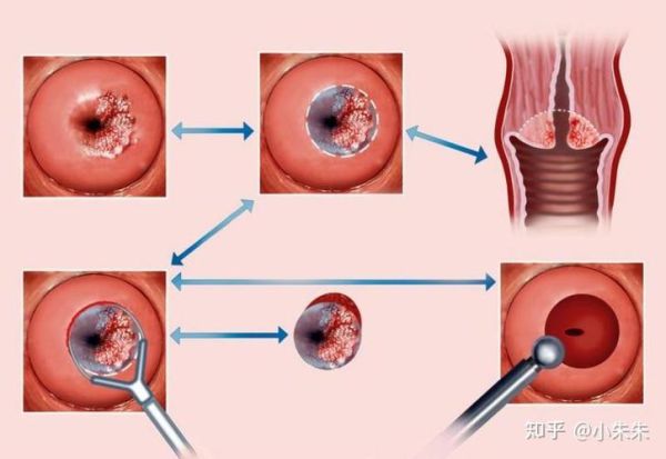 醋酸白试验多少钱_做一次需要多长时间-第3张图片-山城妙识