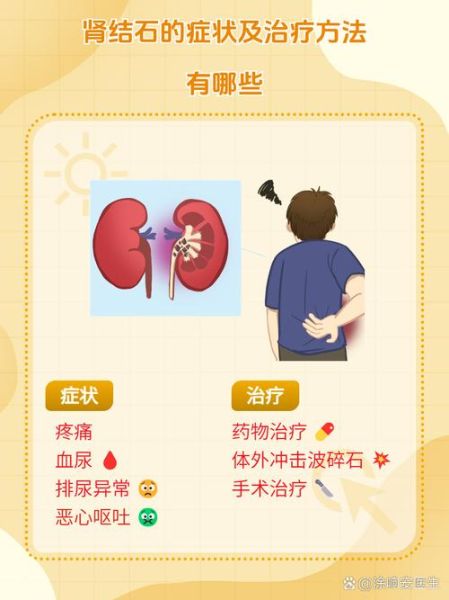 肾结石有什么症状_肾结石疼痛怎么办-第1张图片-山城妙识 肾结石有什么症状_肾结石疼痛怎么办-第1张图片-山城妙识