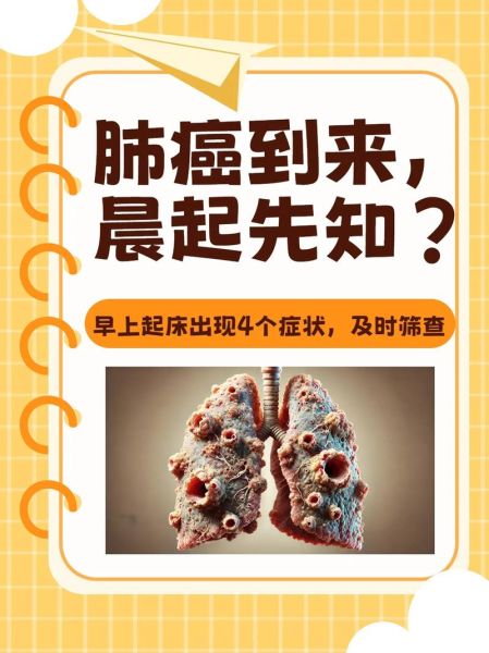 肺癌早期症状有哪些_肺癌早期能活多久-第1张图片-山城妙识