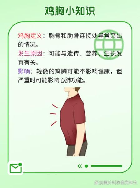 鸡胸严重和轻度图片区别_如何判断鸡胸程度-第3张图片-山城妙识